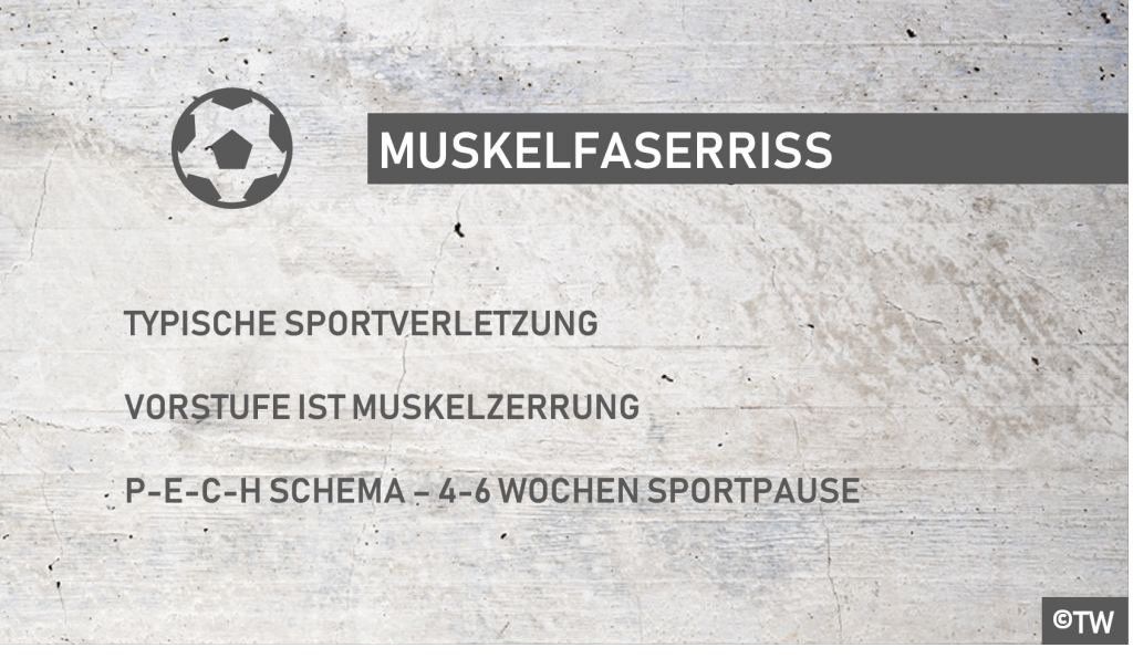DoktorWeigl erklärt Der Muskelfaserriss – Eine typische Sportverletzung