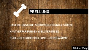 DoktorWeigl erklärt Prellung (Kontusion) – harmlose Alltagsverletzung?