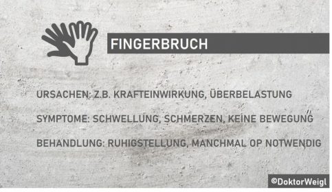 Fingerbruch – Was ist jetzt wichtig? Dauer und Behandlung